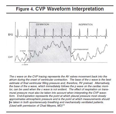 Central Venous Pressure